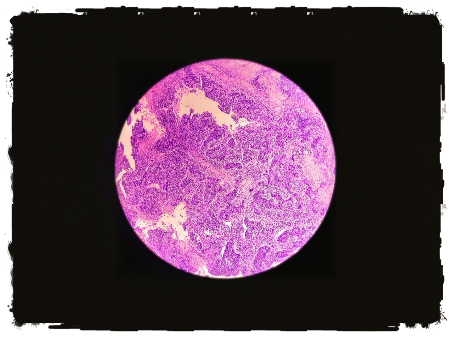 Deadly Flu Strikes Again! Here’s Your Best Shot to Stay Safe | HealthToday