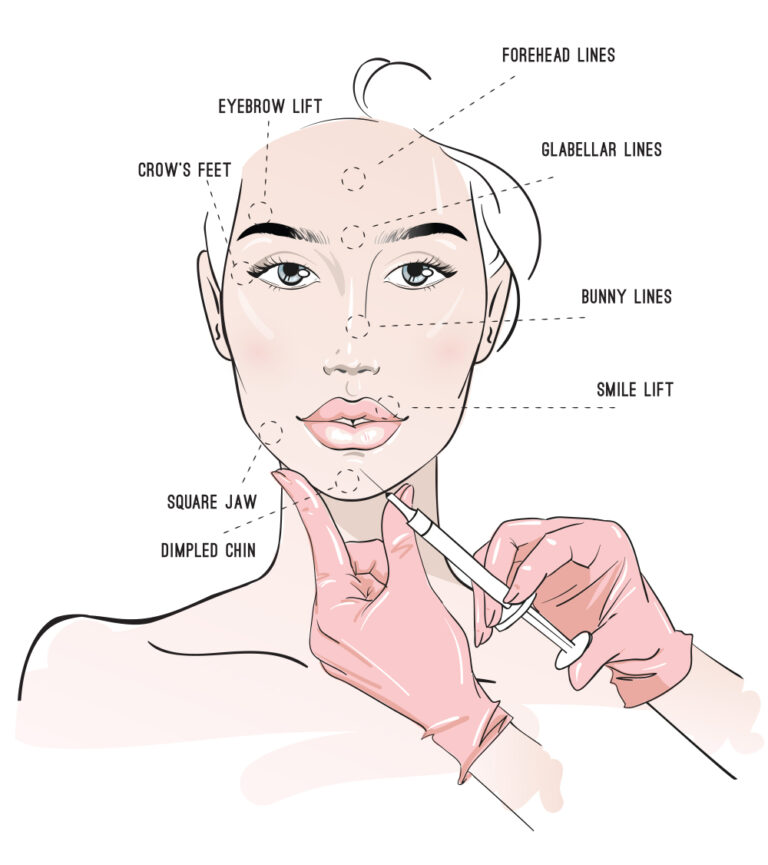 Fillers Gone Wrong! The Truth about Filler Fails and Fixes | HealthToday