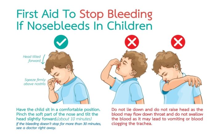 Deadly Nosebleeds: Who Is Most at Risk and What Can Be Done | HealthToday